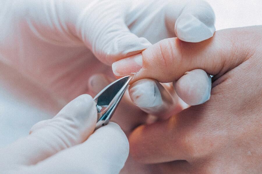 Unhas descamando? 5 dicas ótimas para resolver o problema - Pátio Hype